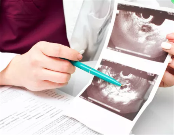 HRC专家科普：第三代试管婴儿PGT-A、PGT-M和PGT-SR技术！【荐】–美国HRC